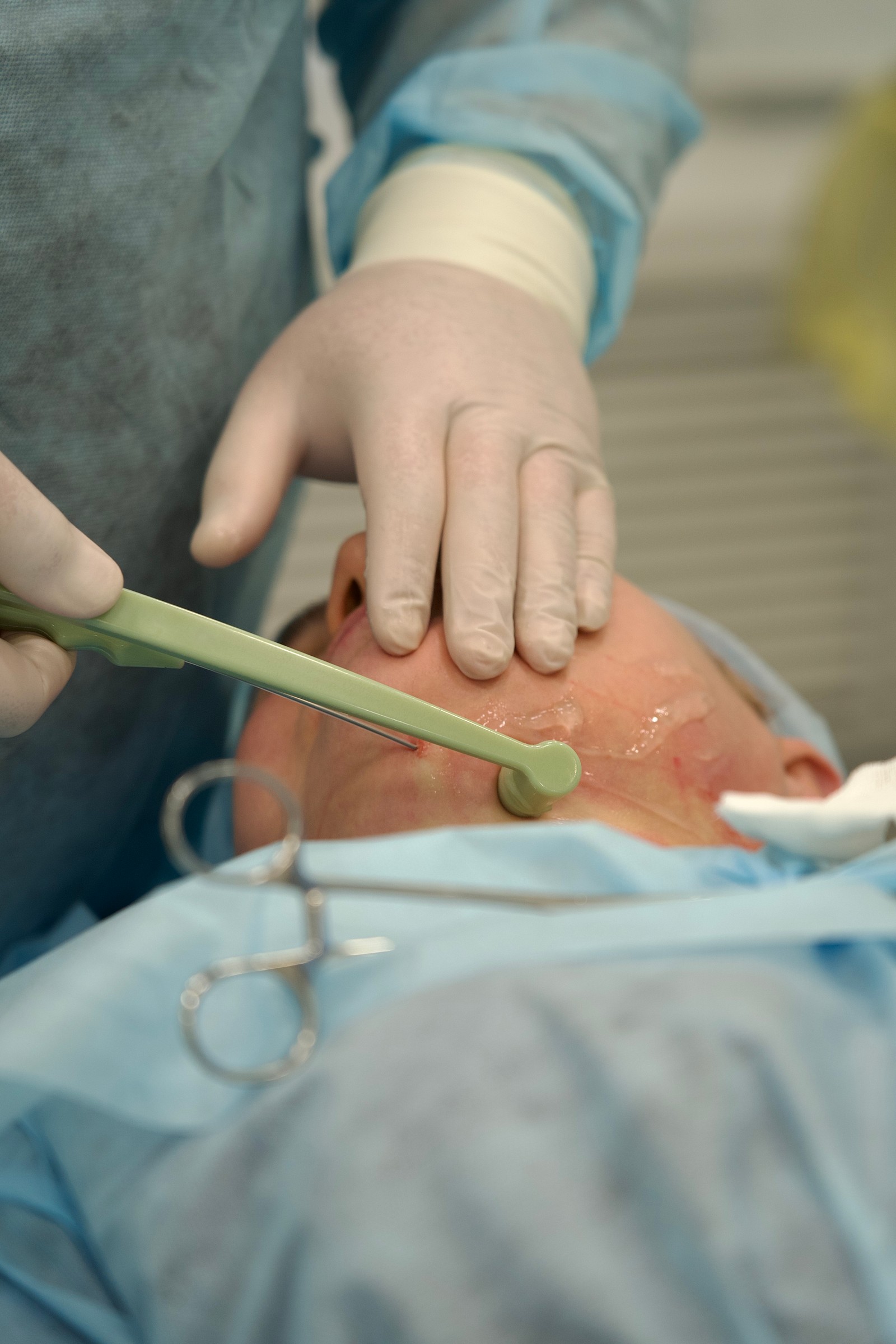 29 марта 2025 г. - Показательный мастер-класс по технологии FaceTite ...